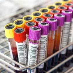 R S Pathalogy Lab, Malad West - Pathology Labs in Mumbai - Justdial