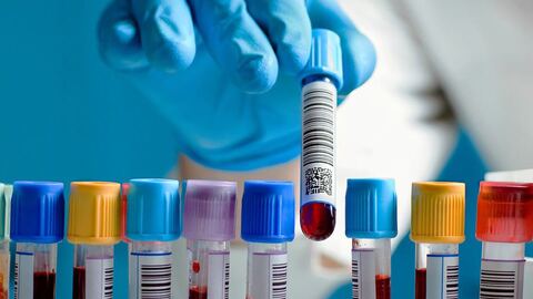 Health Solutions (Vcm Diagnostics), Malad West - Pathology Labs in ...